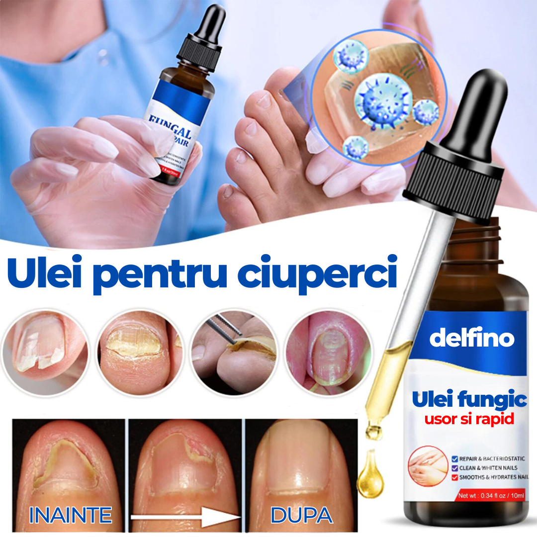 Ulei fungic pentru ciuperca fungica - Delfino®️ - 🇷🇴-Delfino Romania